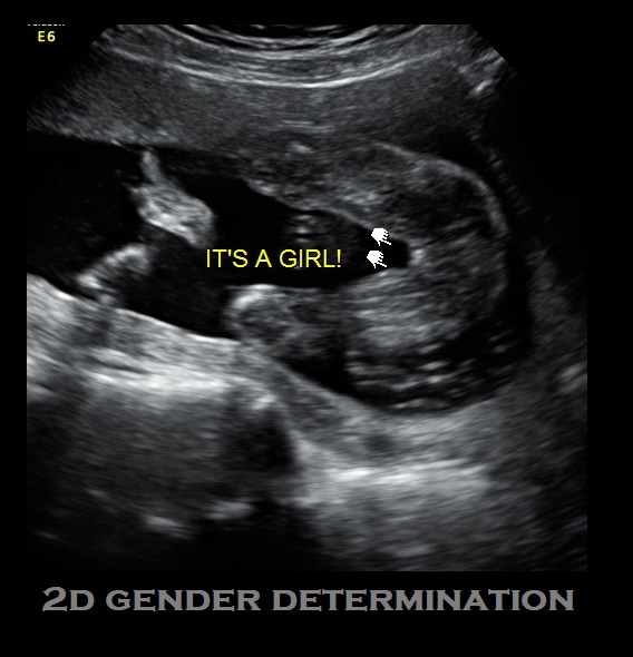 2D/3D/4D and new HD-Live Ultrasound Prices.